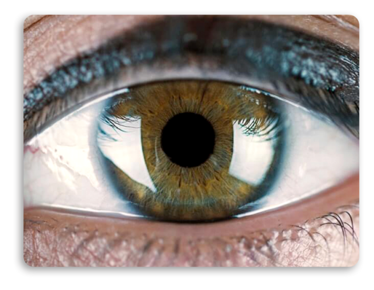 Eye Conditions - Clervision